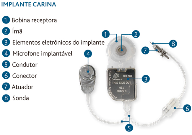 Carina - Produtos - Politec Saúde
